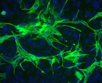 Purchase Cell Line Products Here - Glow Biologics